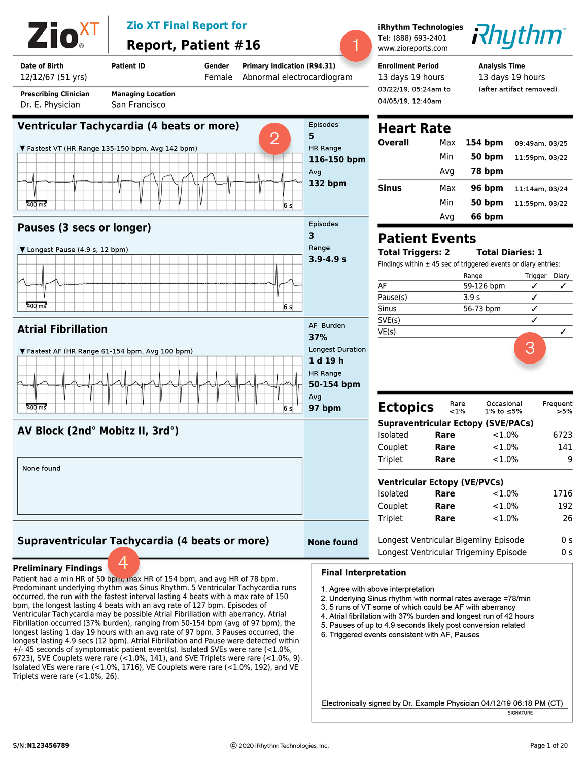 Zio® Patient Report: Actionable Cardiac Insights