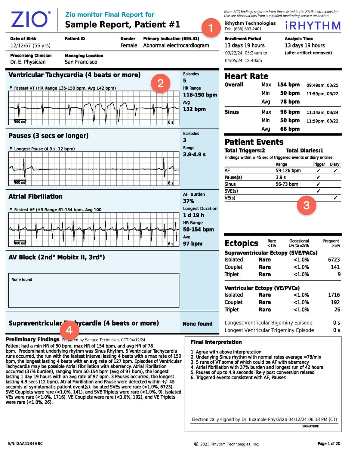 Zio® Report: Actionable Cardiac Insights for Clinicians | iRhythm