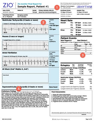 Zio® Report: Actionable Cardiac Insights for Clinicians | iRhythm