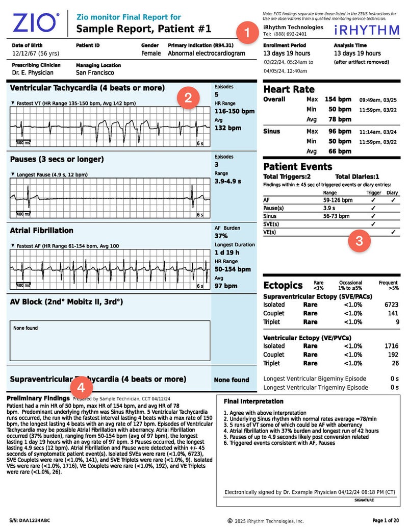 Zio® Report: Actionable Cardiac Insights for Clinicians | iRhythm