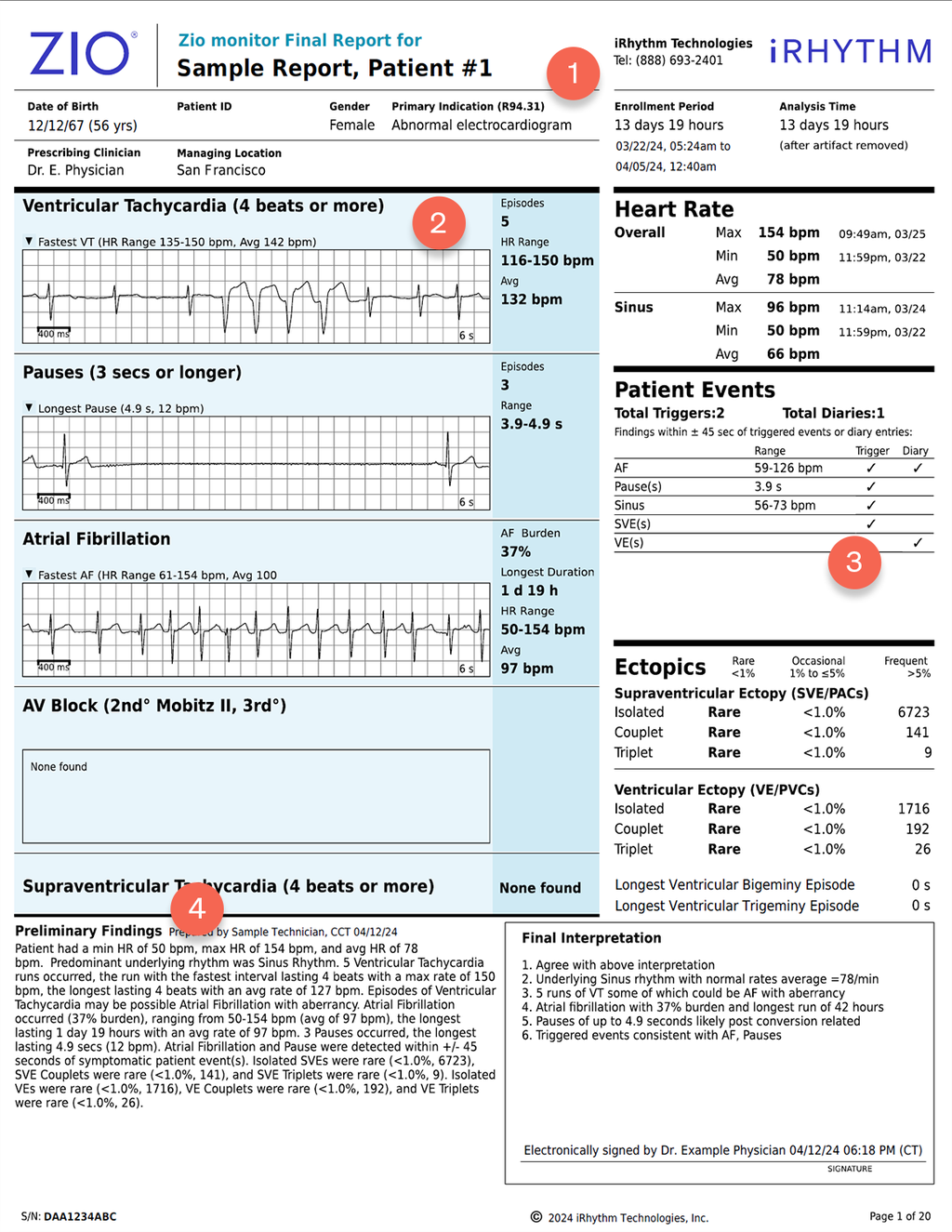 Zio® Report: Actionable Cardiac Insights for Clinicians | iRhythm