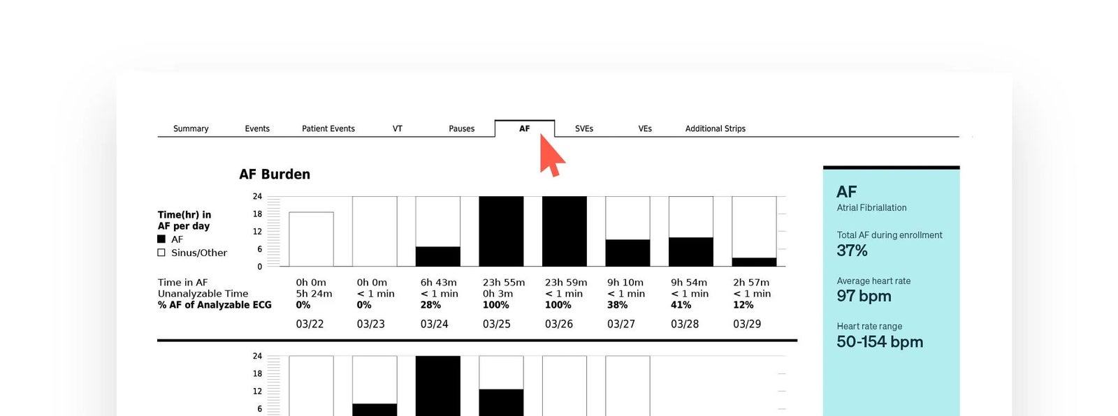 Zio® Report: Actionable Cardiac Insights for Clinicians | iRhythm