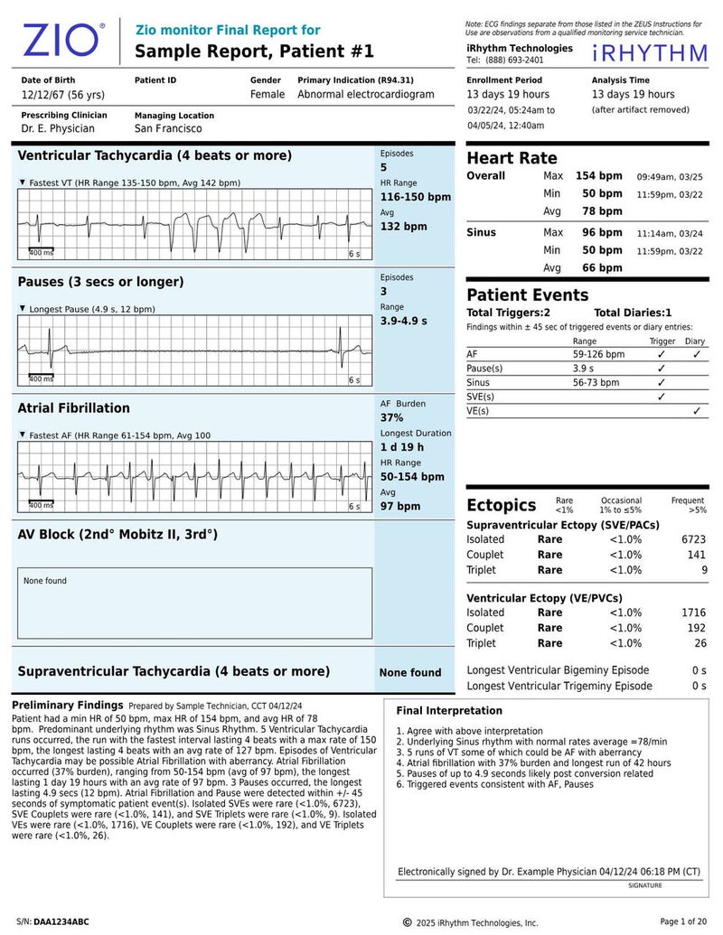 Continuous ECG Monitoring Devices | iRhythm Zio® Cardiac Monitoring ...